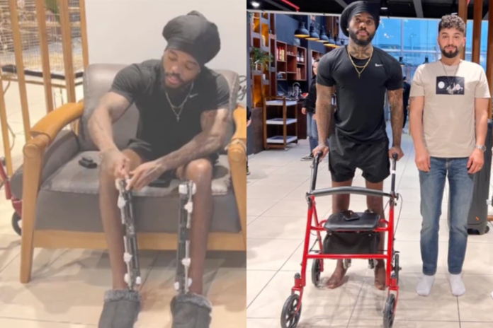 Daddy long legs: Man spends R1.5m on surgery to become taller